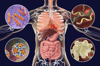 The 10 Most Common Bloodborne Pathogens: Quick Guide